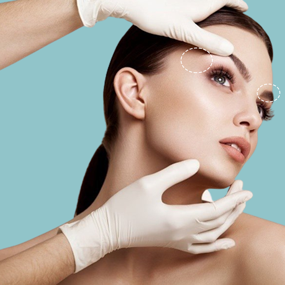 Operasi Implan Pelipis - Klinik Bedah Plastik Queen