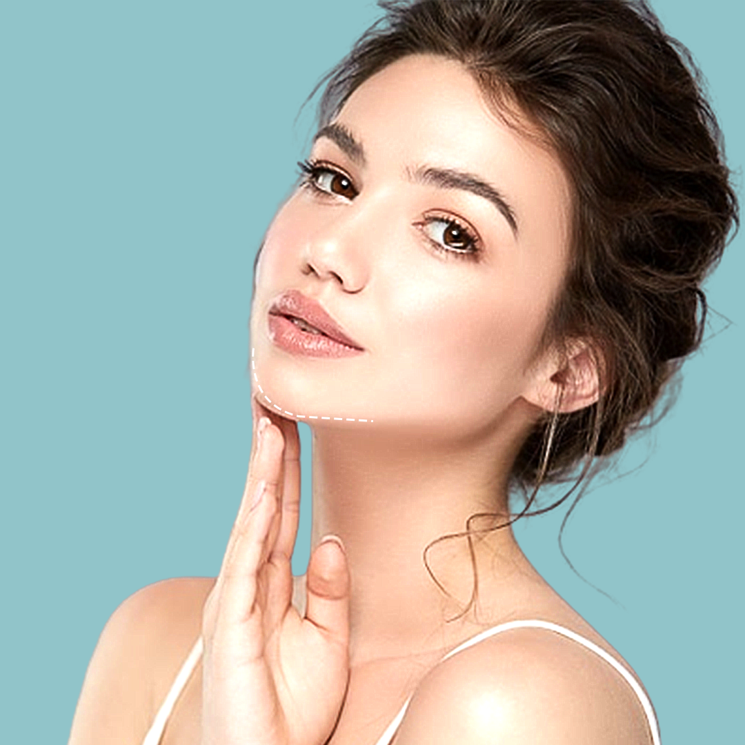 Dagu Revisi - Klinik Bedah Plastik Queen