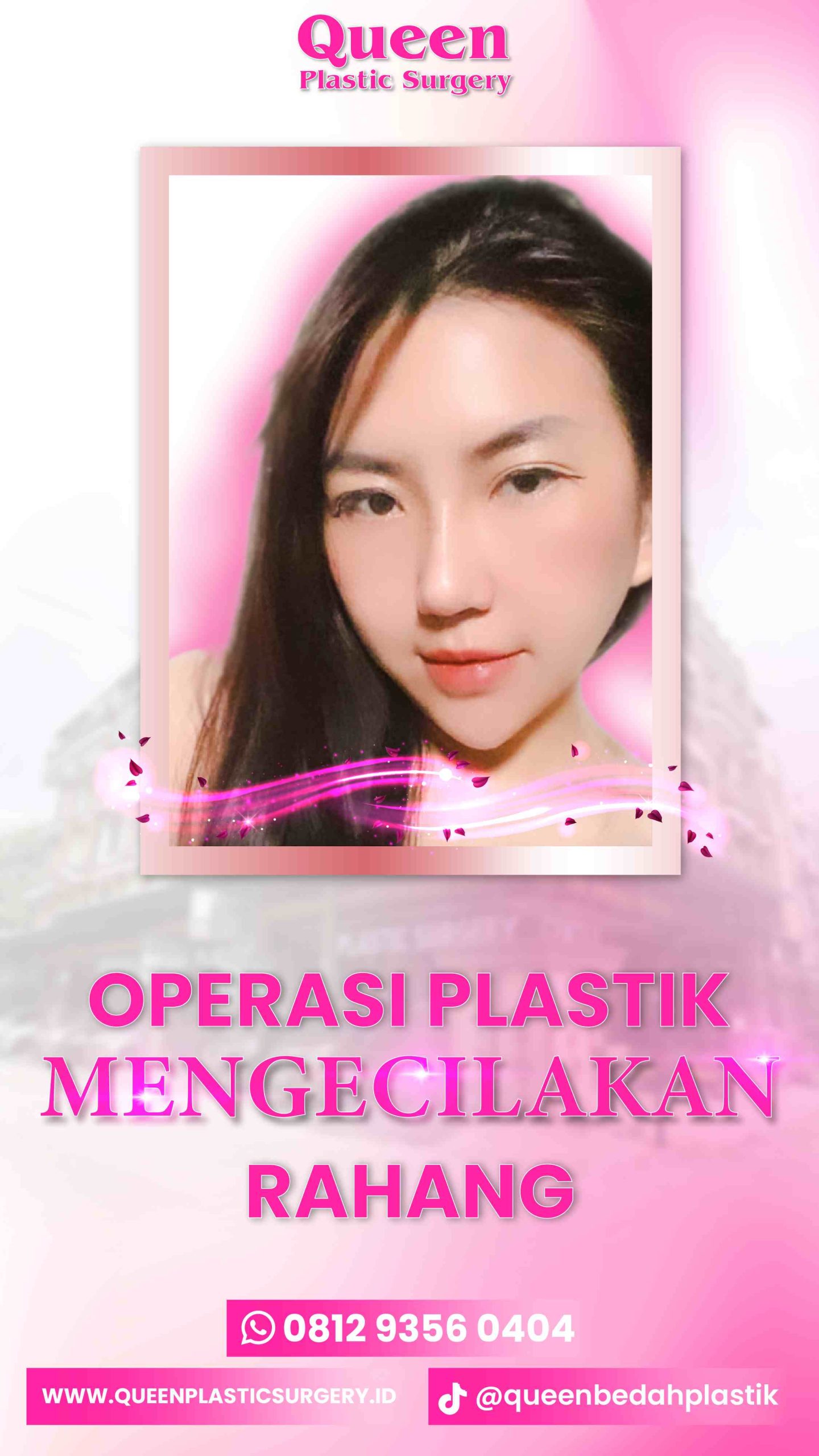 Operasi Plastik Mengecilkan Rahang - Klinik Bedah Plastik Queen