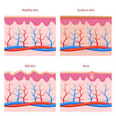 CIRI KULIT YANG SEHAT - Klinik Bedah Plastik Queen