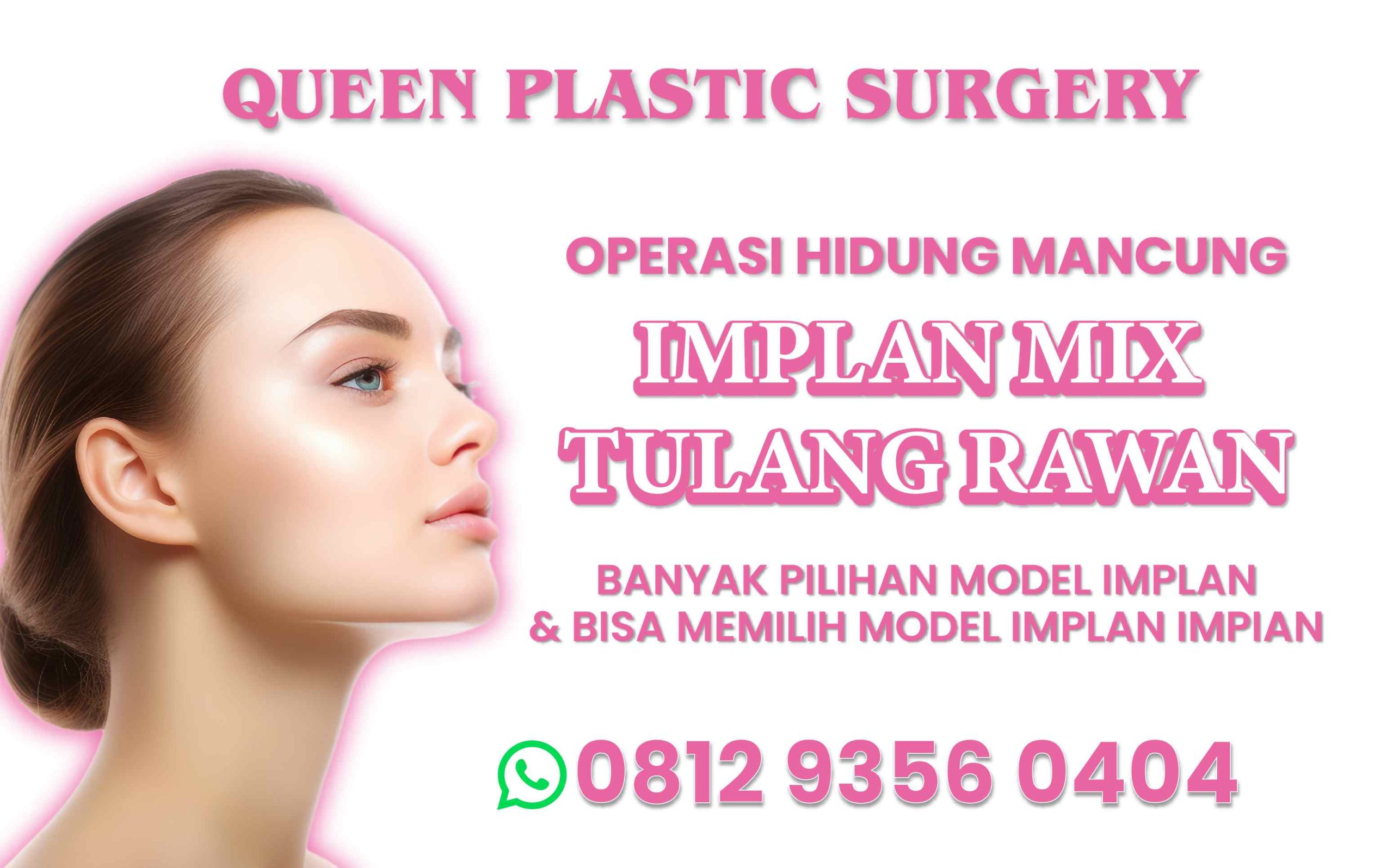 Operasi Hidung Tulang Rawan - Klinik Bedah Plastik Queen
