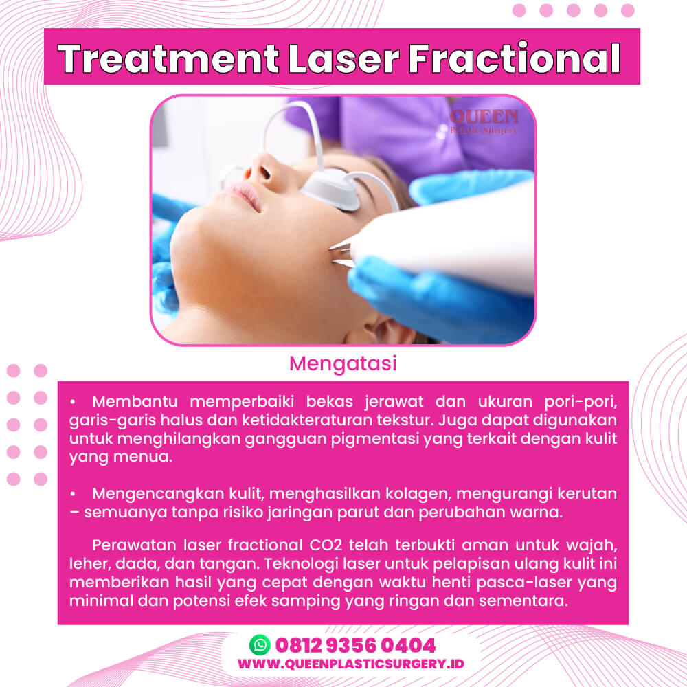 CHEMICAL PEELING VS PERAWATAN LASER: MANA YANG TEPAT UNTUK ANDA ...
