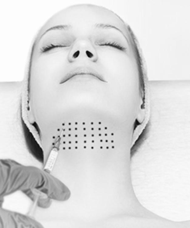 PERAWATAN TERBAIK UNTUK DOUBLE CHIN - Klinik Bedah Plastik Queen