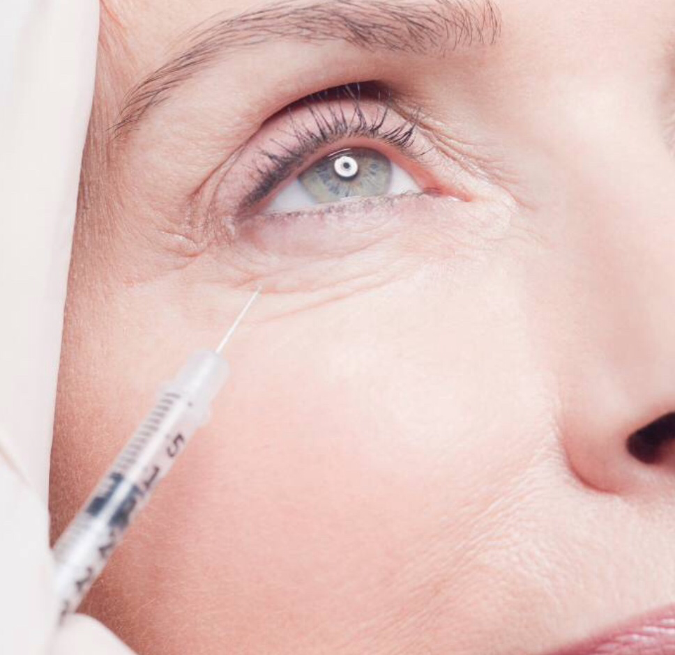 BOTOX BAWAH MATA - Klinik Bedah Plastik Queen
