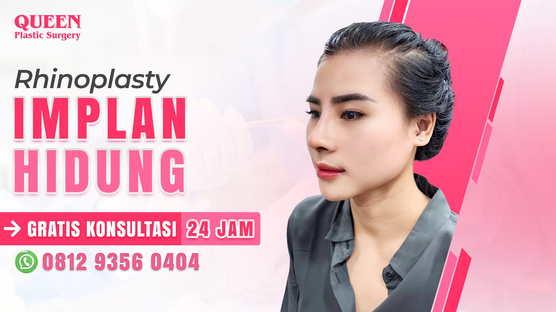 LUKA - TIPS MEMINIMALKAN LUKA RHINOPLASTY - Klinik Bedah Plastik Queen