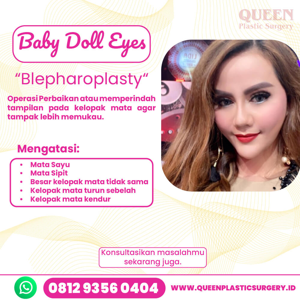 Operasi Kelopak Mata Dapat Mengubah Bentuk Mata? - Klinik Bedah Plastik ...