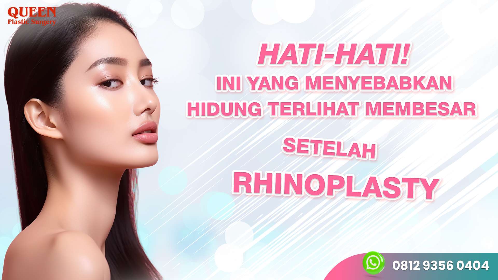 Ini yang Menyebabkan Hidung Membesar Setelah Rhinoplasty - Klinik Bedah ...